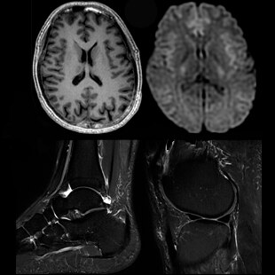 SIGNA™ Pioneer | GE Healthcare