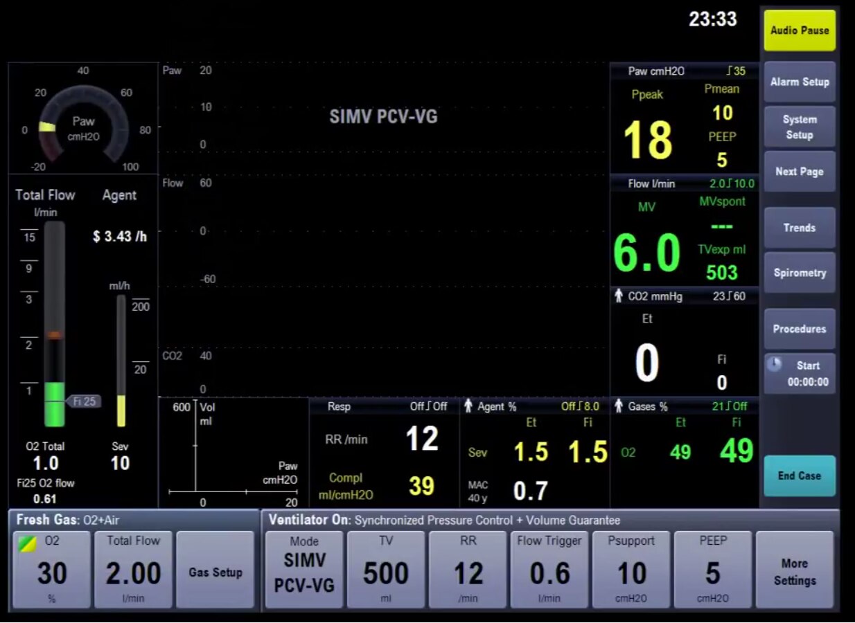 Aisys CS² | GE Healthcare