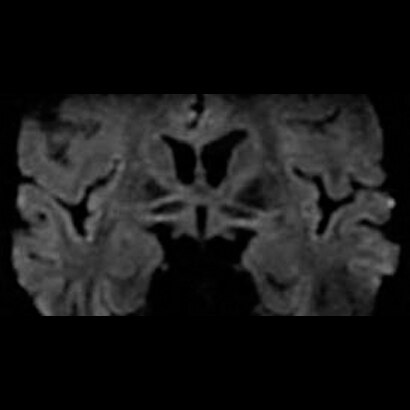 SIGNA™ Pioneer | GE Healthcare