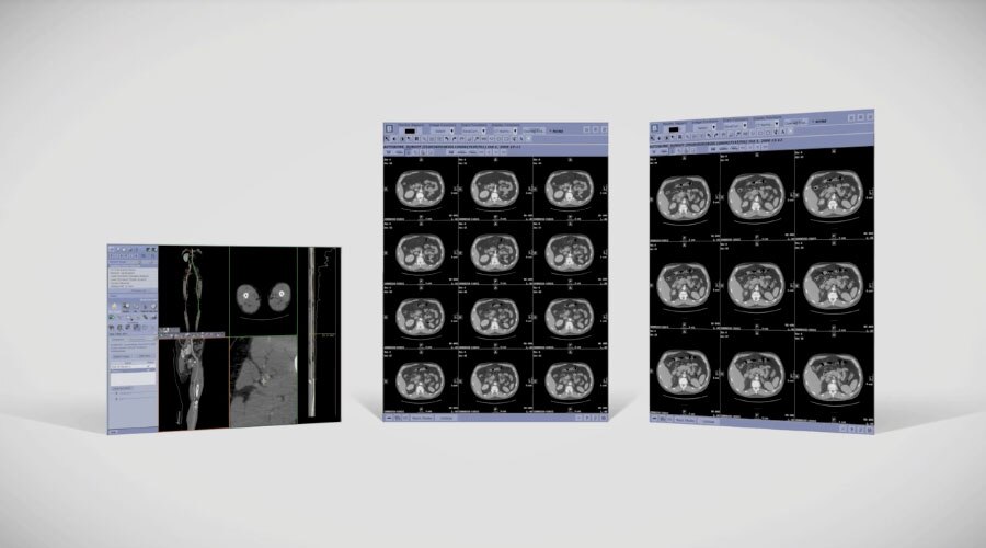 Integração do AW Server ao PACS | GE Healthcare