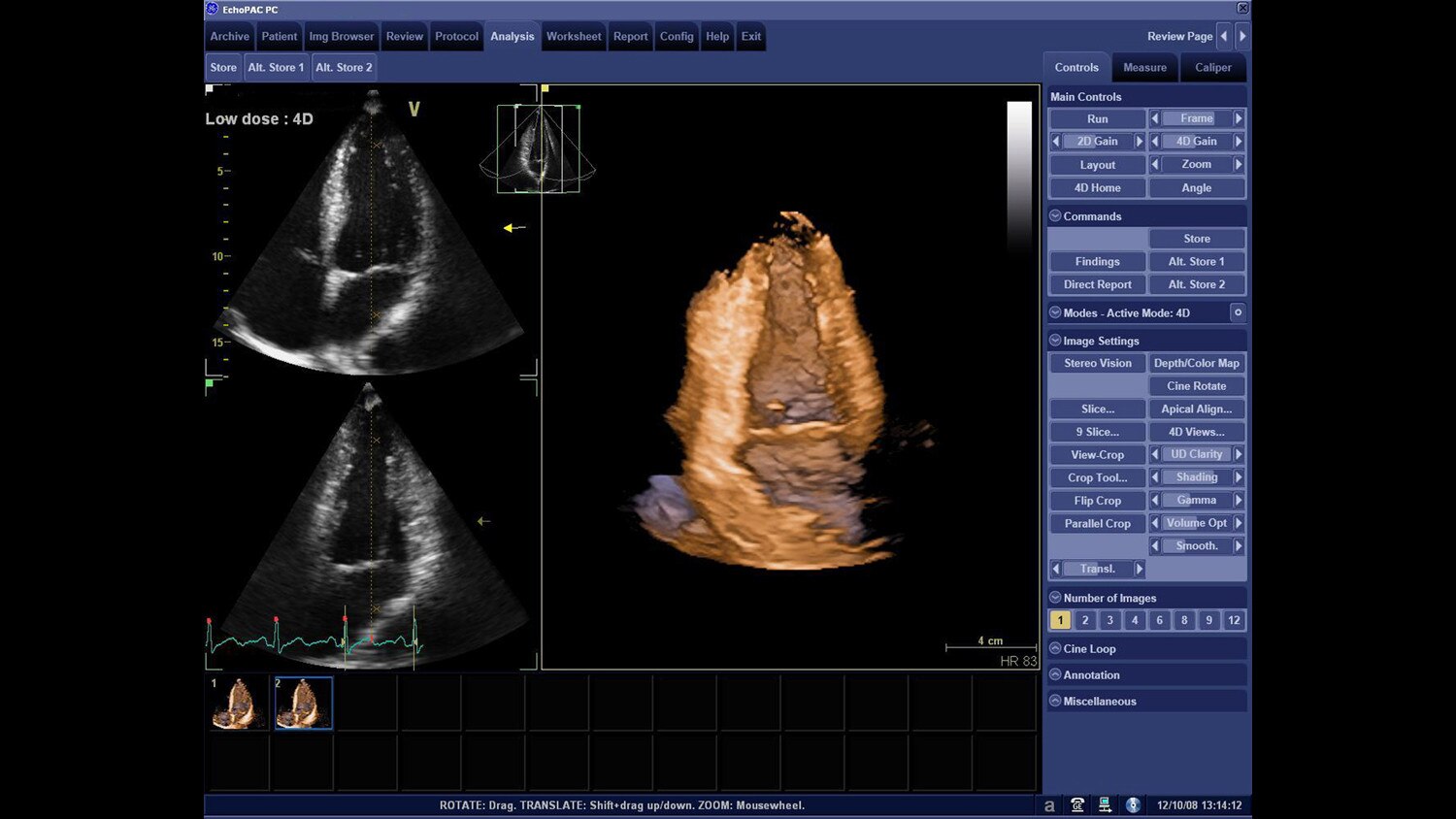 Software EchoPAC Clinical Workstation | GE Healthcare