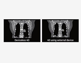 Smart Deviceless 4D| GE HealthCare