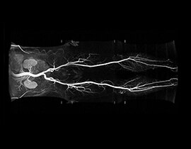 Aplicativo de RM quickstep | GE HealthCare