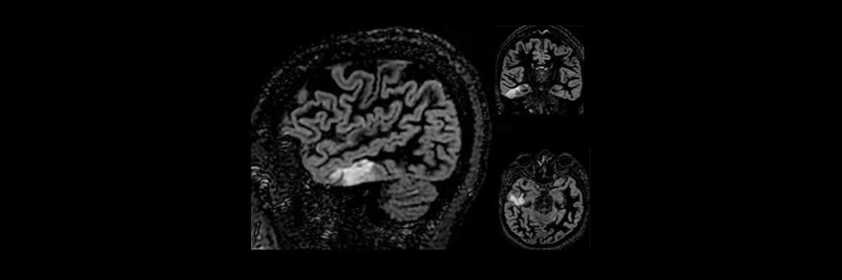 NeuroWorks| GE Healthcare