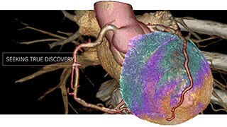 Molecular Imaging| GE HealthCare