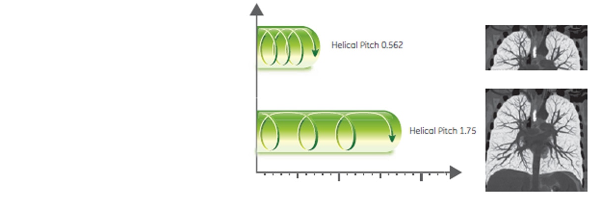 IQ Enhance| GE HealthCare